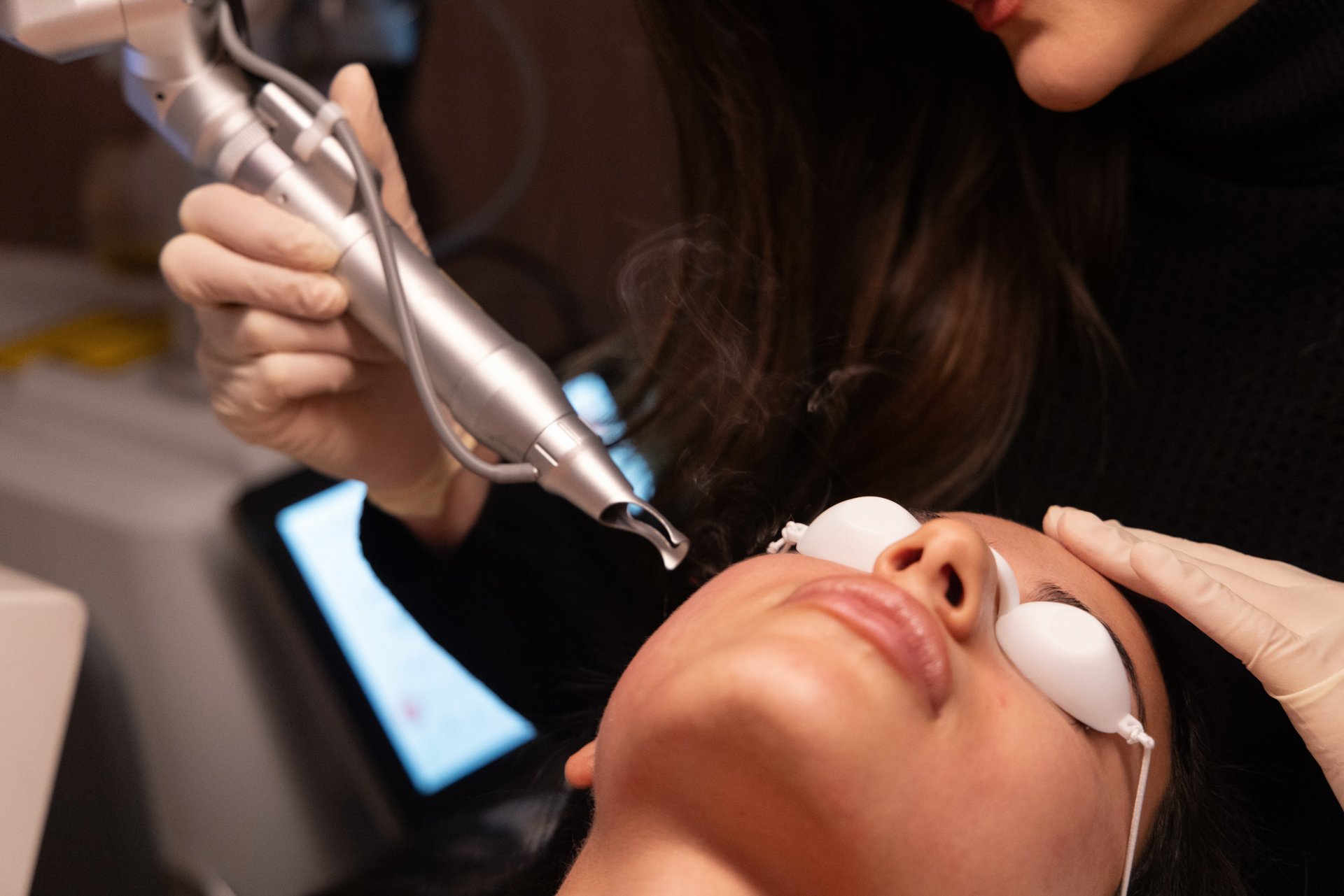Bare Skin - Laser rejuvenation session ($300 value) | AirAuctioneer